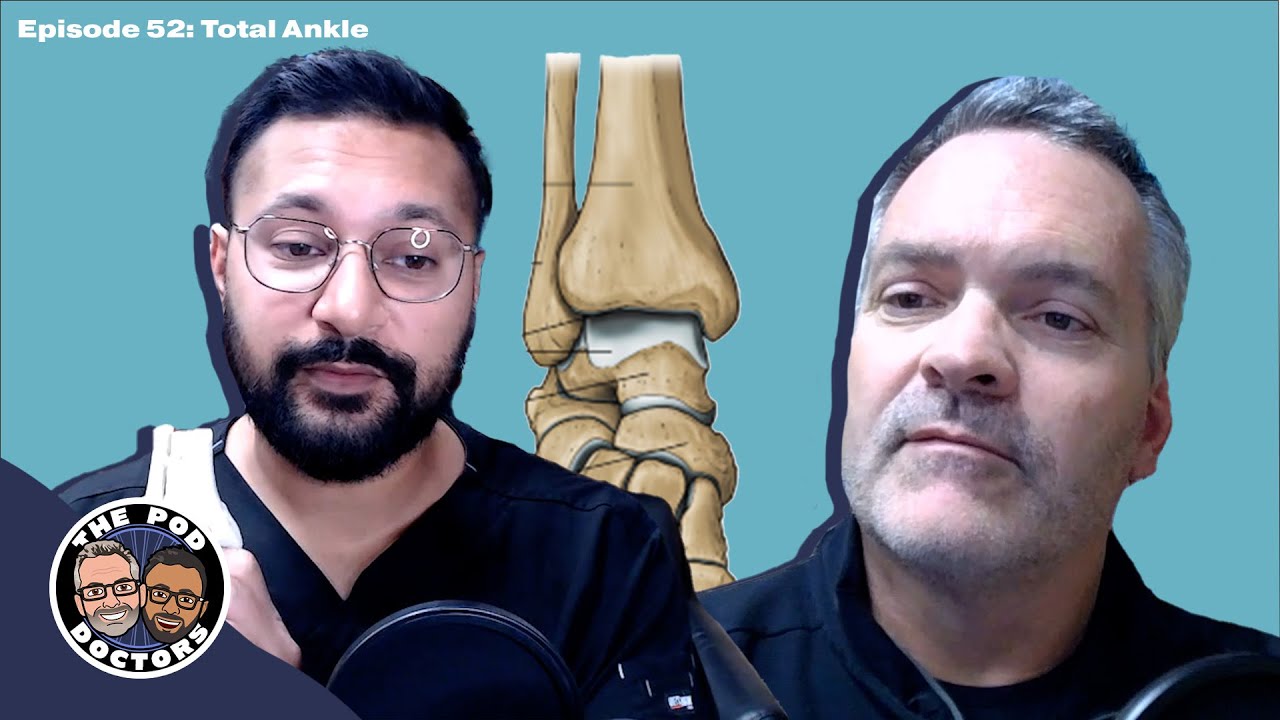 Ankle Replacement Options & Recovery