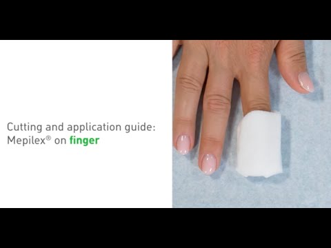 How to apply Mepilex on a finger