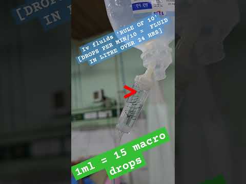 IV FLUIDs drop calculation