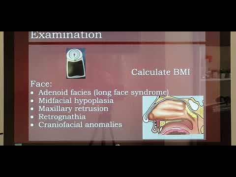 Obstructive sleep apnea in Children Patient teaching programme Part 2 Tamil