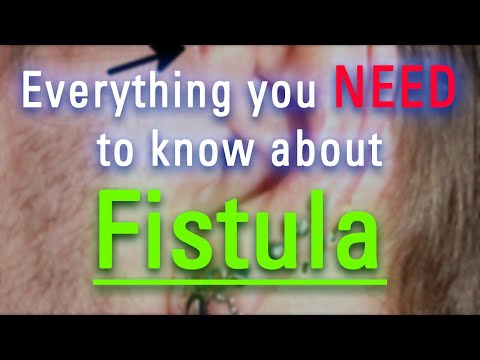 How to Say Fistula in English? | How Does Fistula Look? | What is Fistula?