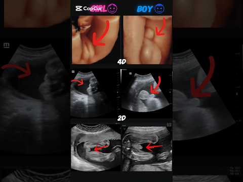 Baby boy, baby girl, what bundle of joy are you carrying? #baby #babygirl #shorts