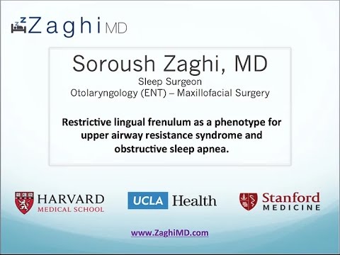 Lecture #1: Introduction to ankyloglossia and UARS (AAMS Congress, March 2017).