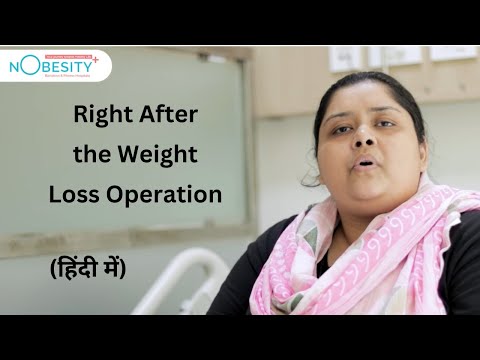 Weight Loss Surgery Experience: (Hindi) | Bariatric Surgery Success in India at NObesity