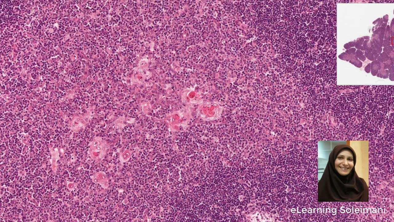 Practical Histology, Thymus, English