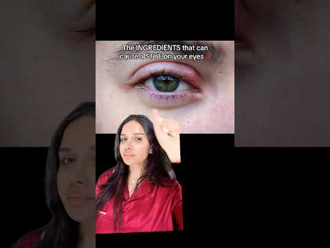 These can cause a Stye on your eyes! #skincareproblems #acneskincare #stye #eyes #skincareroutine