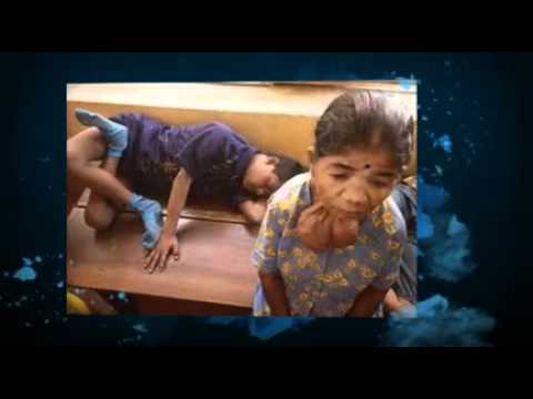 ENDOSULPHAN VICTMS IN INDIA visit http://endosulfan.webs.com