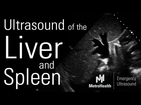 Ultrasound of the Liver & Spleen