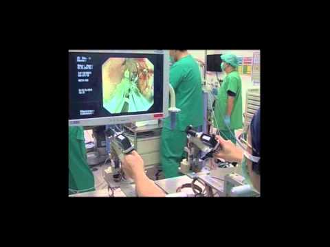 Robot-Assisted Endoscopic Submucosal Dissection Is Effective in Treating Patients...