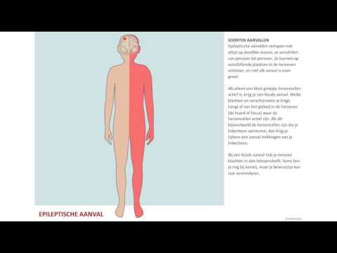 Epileptische aanval