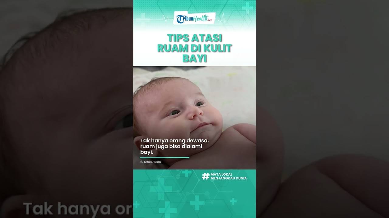 Cara Atasi Ruam di Kulit Bayi yang Perlu Diketahui Orangtua, Oleskan ...