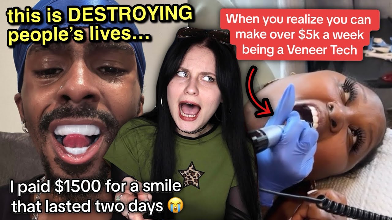 THE RISE OF BAD VENEER JOBS.....THAT STEVE HARVEY LOOK🤣 - Toronto ...