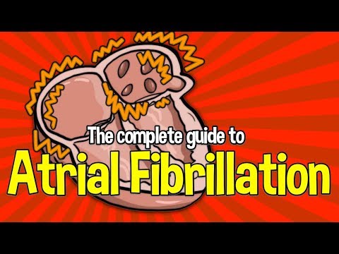 Complete Guide To Atrial Fibrillation: Causes, symptoms and treatments