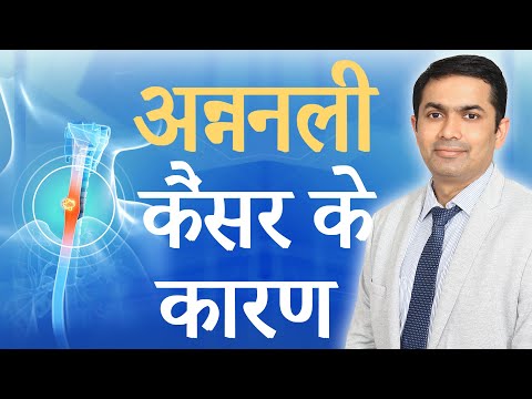 अन्ननली कैंसर के कारण | Causes of Esophageal cancer in Hindi