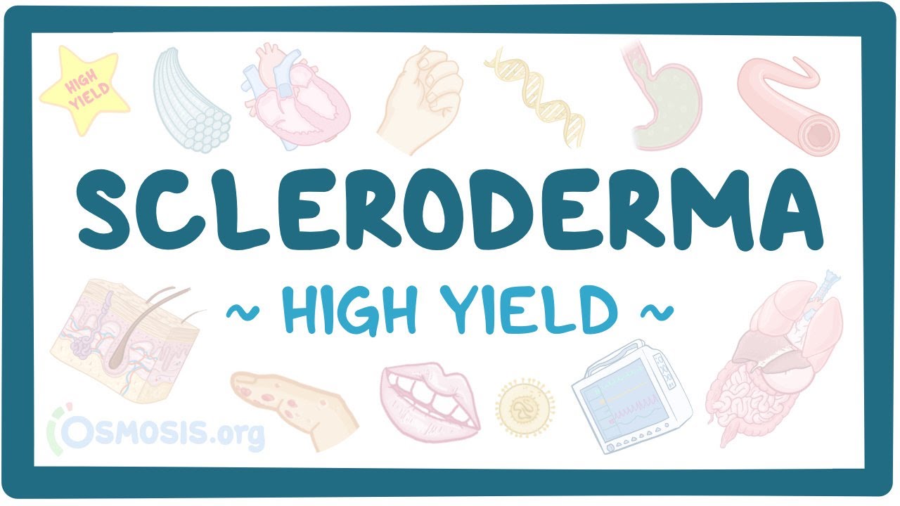 Scleroderma: Pathology review