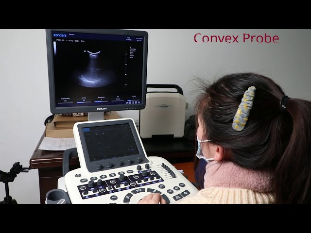Ultrasound Machine - Zoncare Q7 Ultrasound Machine Service Provider ...