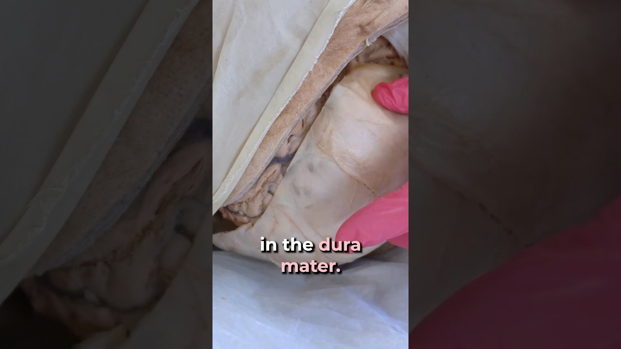 What Surrounds Your Brain That Relates to Migraines?