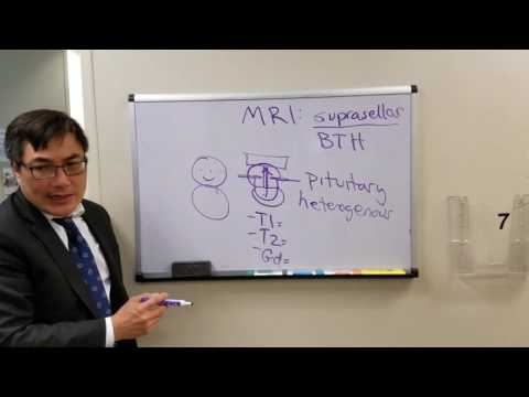 Sellar masses and MRI