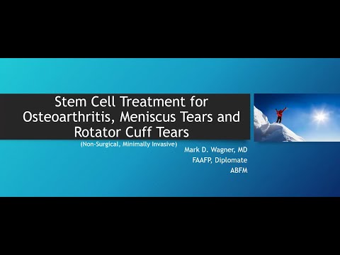 Stem Cell Treatment for Osteoarthritis, Rotator Cuff Tears & Meniscus Tears