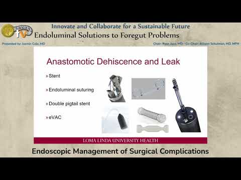 Endoscopic Management of Surgical Complications