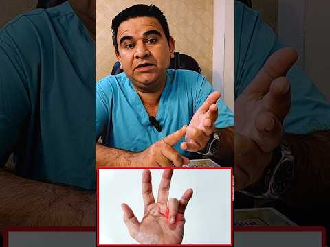 Home Remedies for Trigger Finger: Heal Your Hands Naturally!