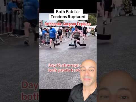 Doctor Explains - Both Patellar Tendons TEAR!
