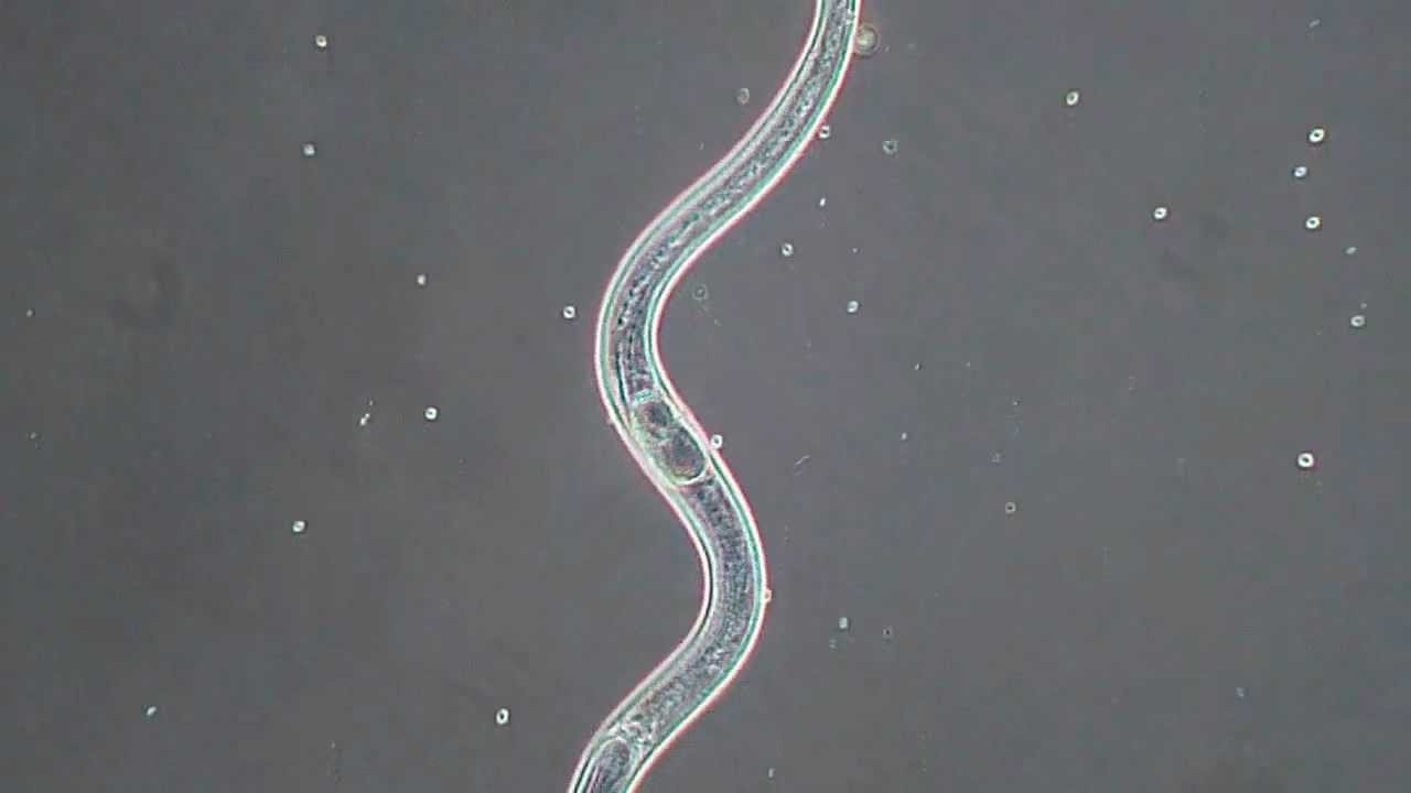 Nematode,200x, Phase contrast