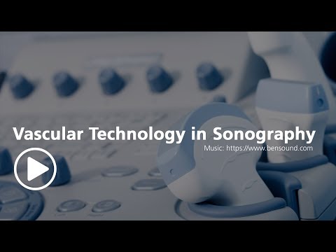 Vascular Sonography