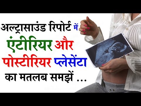 Anterior placenta meaning in hindi || Anterior and posterior placenta in ultrasound of pregnancy