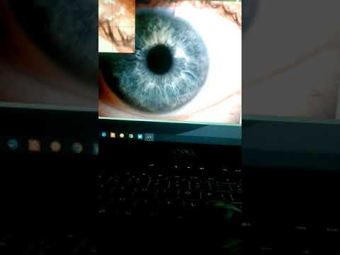 Iridologist exam