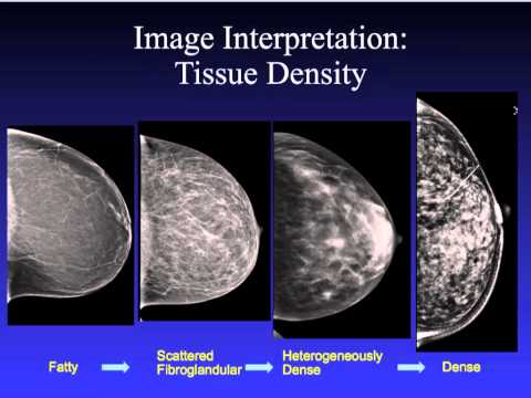 Introduction to Mammography