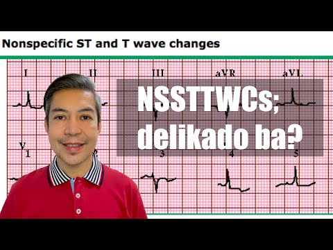 Nonspecific ST-T wave changes, delikado ba?