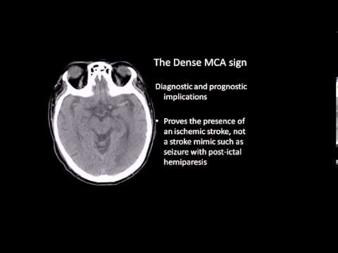 EMedHome - Monthly Video Pearl in Emergency Medicine Radiology - January 2012