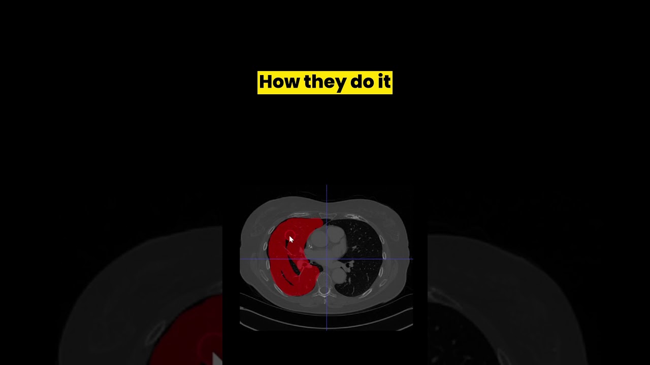 How they do it VS How we do it 🚀 #3dvisualization #medicalimaging #python