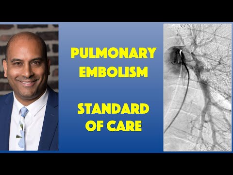 PE: Standard of Care
