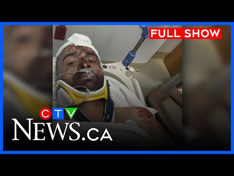 Rockslide survivor | CTV News Calgary at Five for June 23, 2025