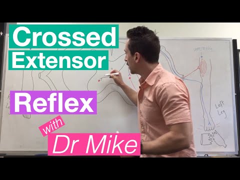 Crossed Extensor Reflex