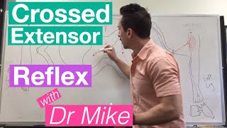 Crossed Extensor Reflex | Pearson+ Channels