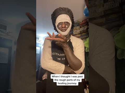 Navigating TSW Healing Journey #topicalsteroidwithdrawal #tswsurvivor