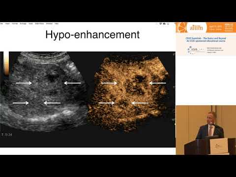 HCC Diagnosis and LI-RADS