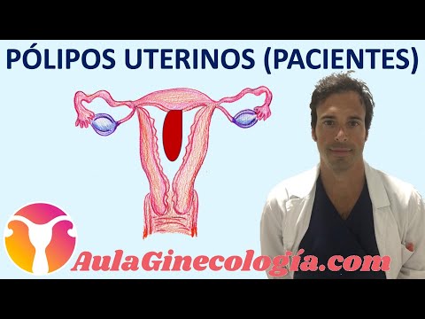PÓLIPOS UTERINOS (PACIENTES): Síntomas, diagnóstico y tratamiento - Ginecología y Obstetricia