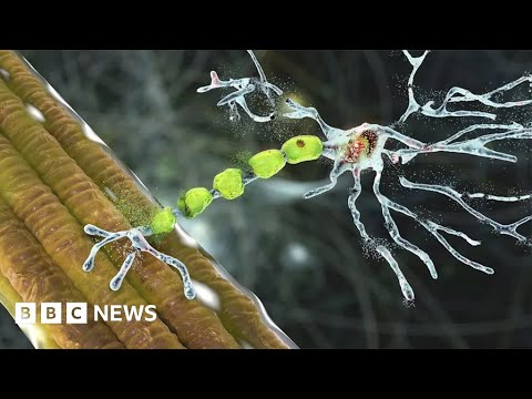 'Truly remarkable' drug can reverse decline caused by motor neurone disease - BBC News