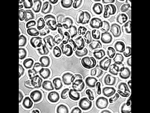 RBC Lysis
