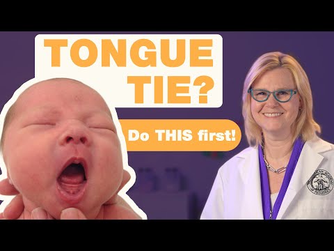 Is Tongue-Tie Surgery Right for Your Baby? Expert Advice for Parents | AAP