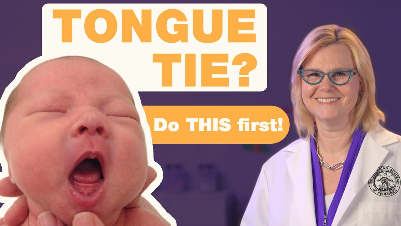 Is Tongue-Tie Surgery Right for Your Baby? Expert Advice for Parents | AAP