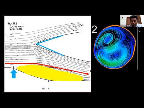 e-Masterclass 5: Stroke due to intracranial arterial wall pathology