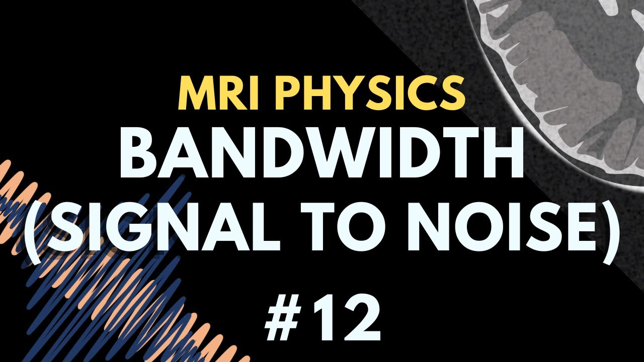 Understanding The Impact Of Bandwidth On Signal To Noise Ratio In Mri Galaxy Ai