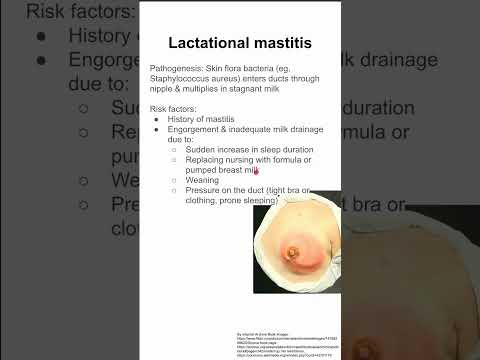 Lactational mastitis
