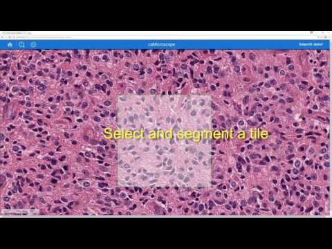 QuIP - System for Generation, Management and Exploration of Features from Whole Slide Tissue Images