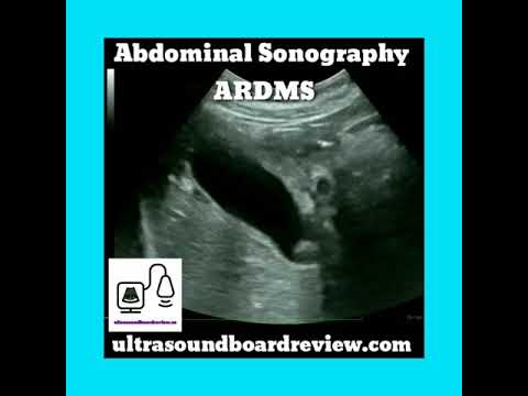 Abdominal Sonography